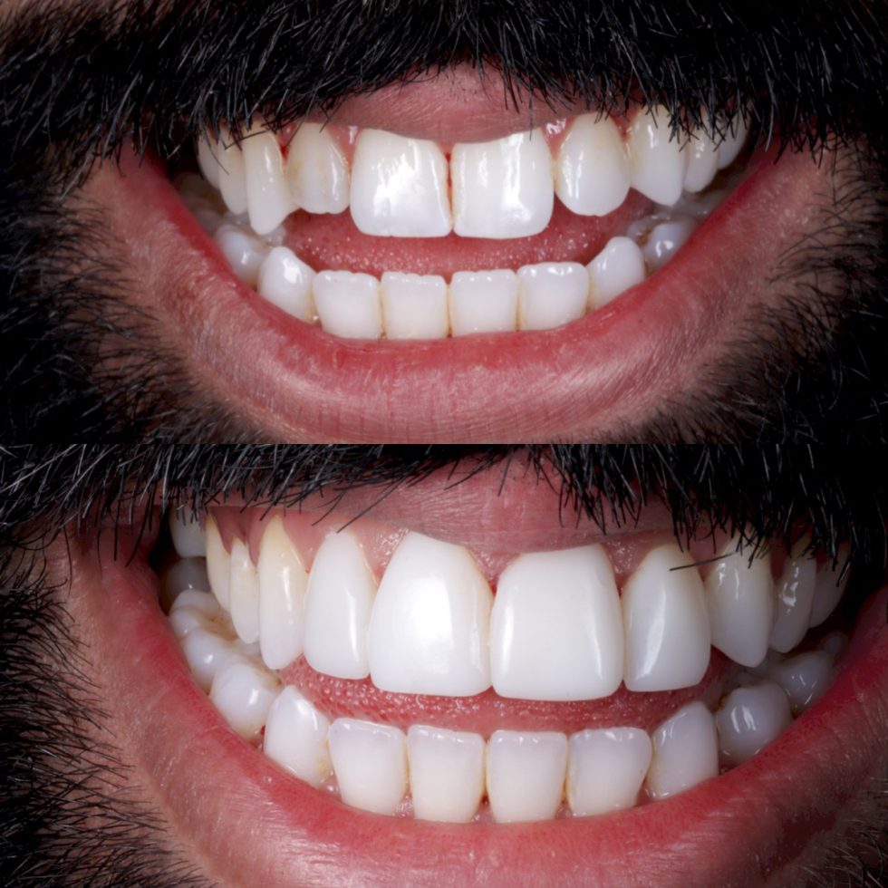 Aurora Dental | Private Dentist in Solihull Town Centre