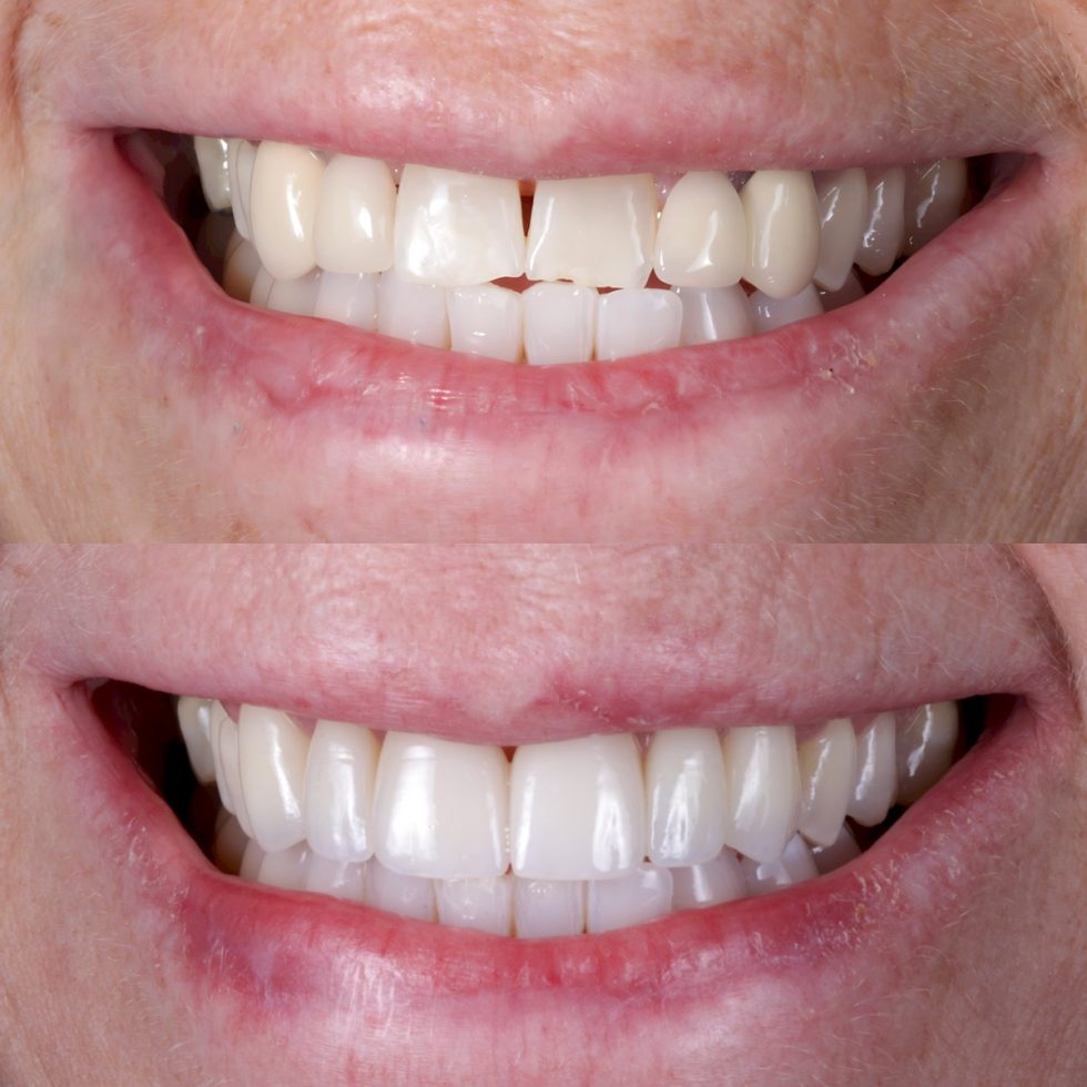 Aurora Dental | Private Dentist in Solihull Town Centre