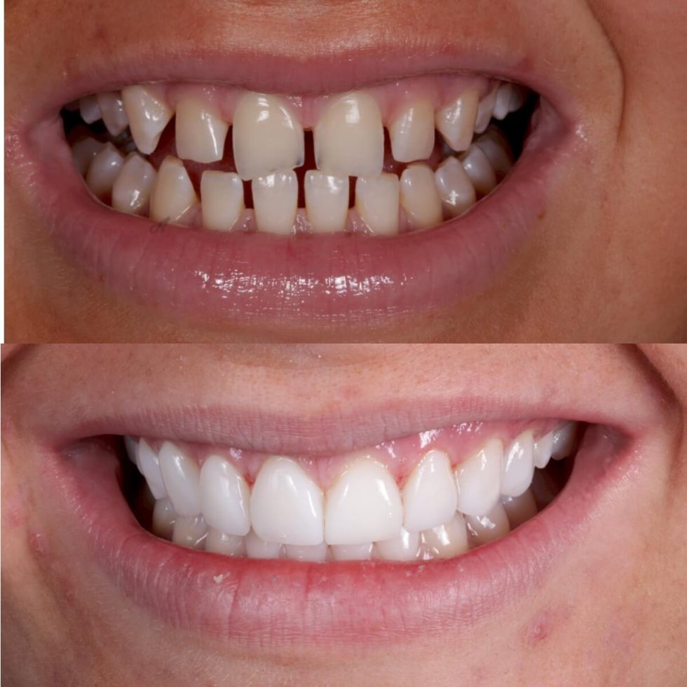 Aurora Dental | Private Dentist in Solihull Town Centre