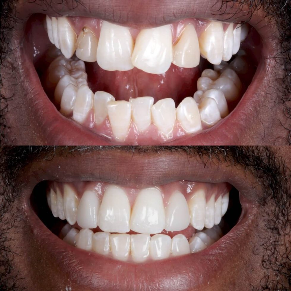 Aurora Dental | Private Dentist in Solihull Town Centre